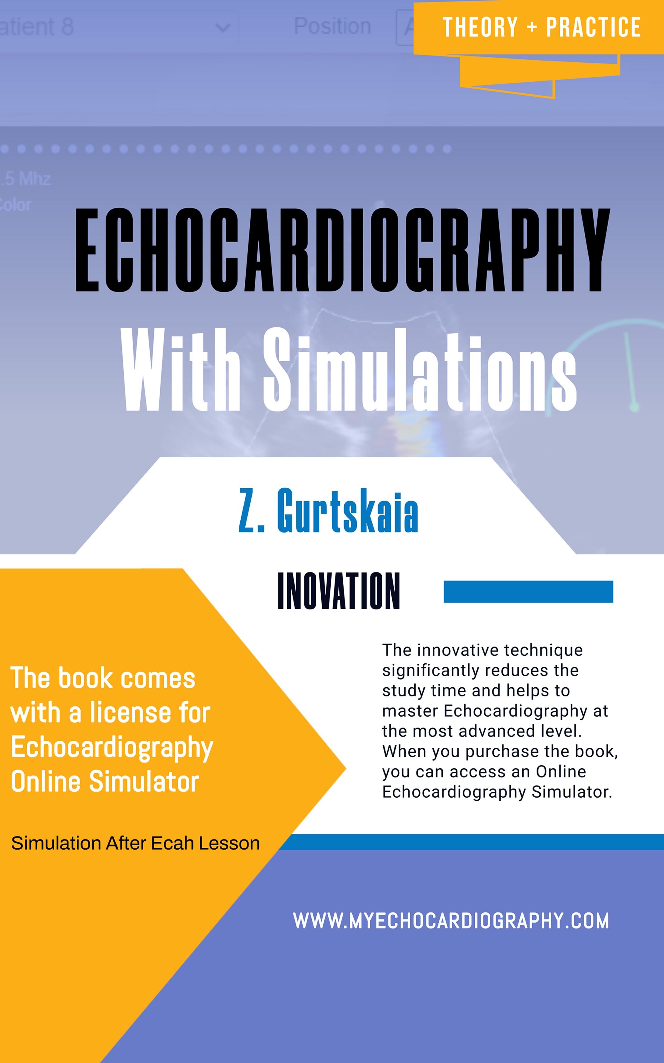 Virtual Echocardiography